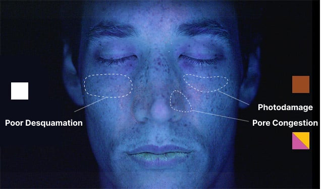 SkinScope Skin Analysis | Face Place Prague
